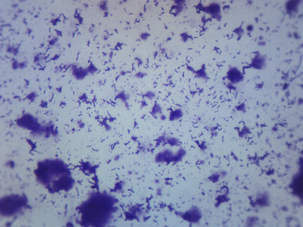 Trichomonas Vaginalis Slide