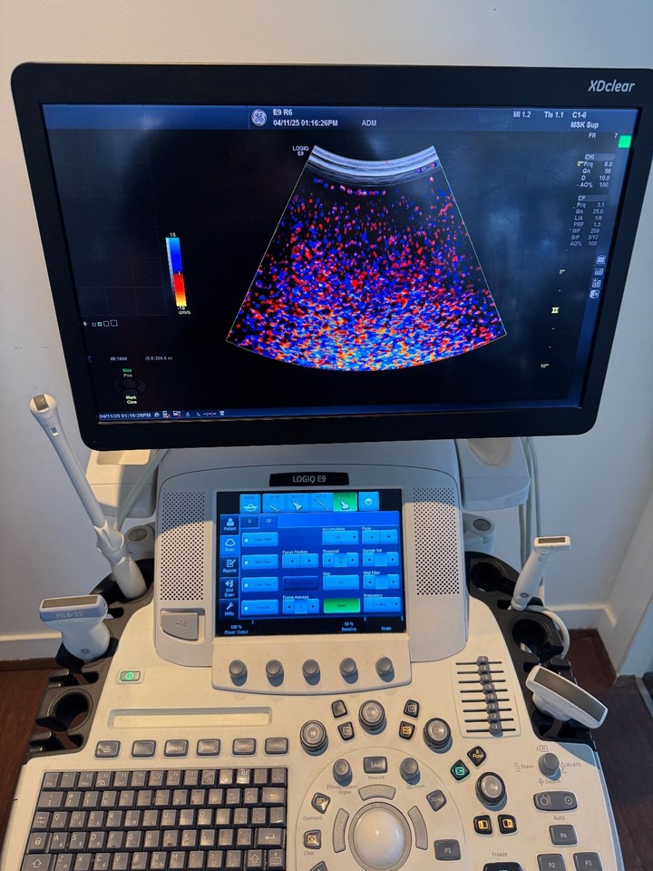 GE LOGIQ E9 R6 ULTRASOUND 4 PROBES 3D/4D ELASTOGRAPHY ML6-15-D C6-1 IC9 ...