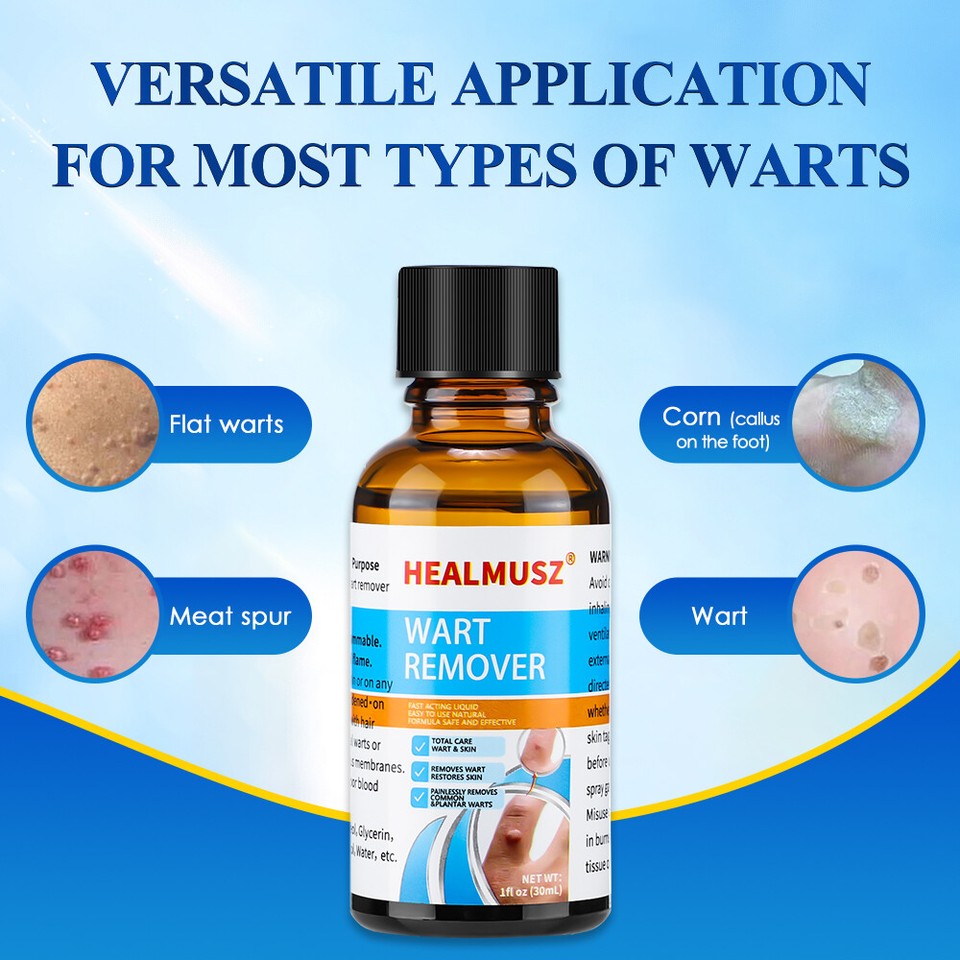 Wart Remover Liquid Skin Tag Remover Eliminate Foot Corn Warts Unisex ...