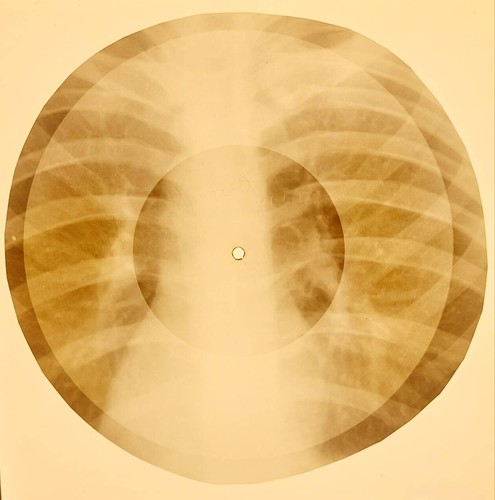X-RAY USSR ROENTGEN BONES RECORD ORIGINAL OLD RIBS 689 | eBay