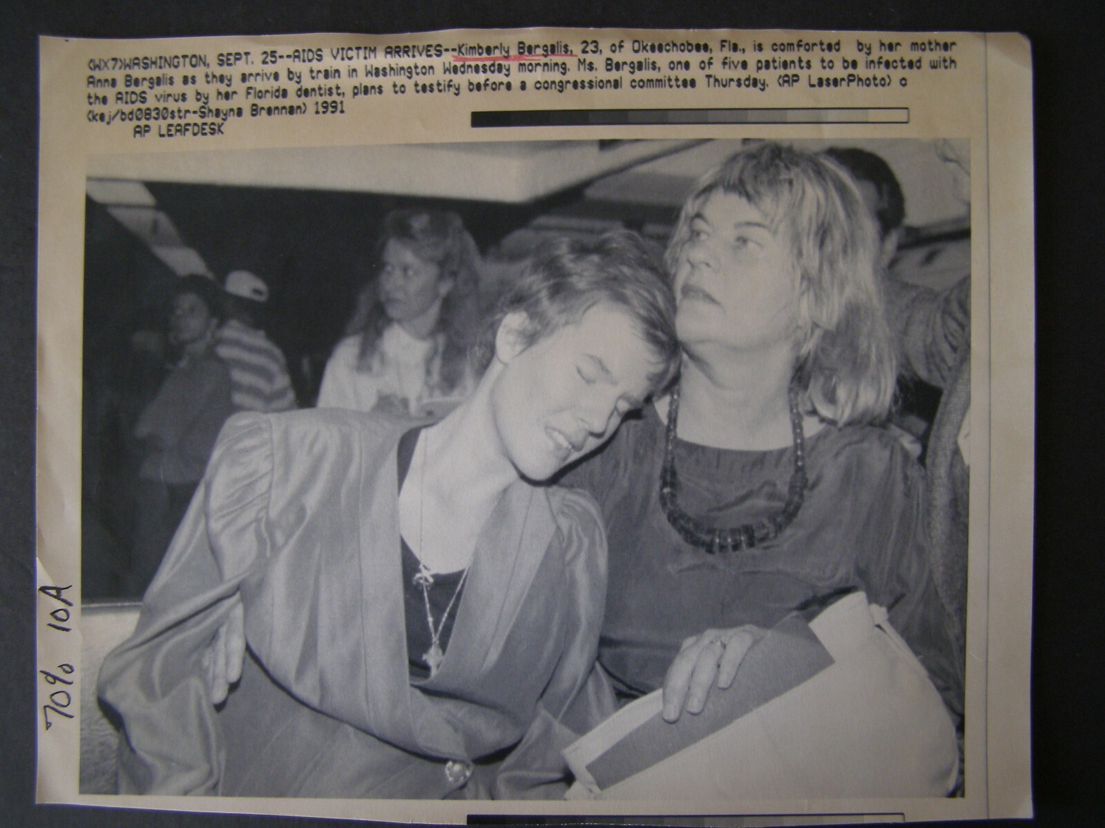 AP Wire Press Photo Kimberly Bergalis of Florida infected with AIDS ...