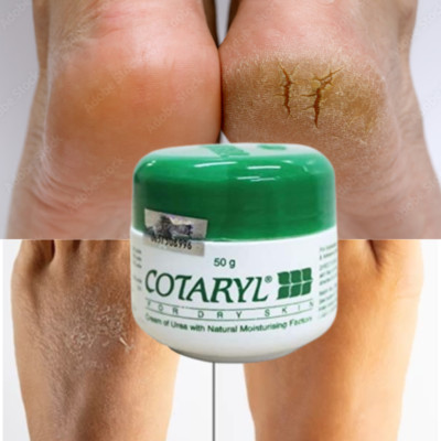 Cotaryl Cream for Moisturizer Healing Foot Cream Callus Treatment 50gm ...