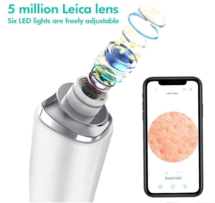 Blackhead Microscope