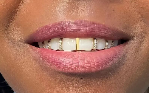 Custom Fit 14K Gold Plated Mouth Teeth Iced CZ Gap Grillz 7pc Set ...