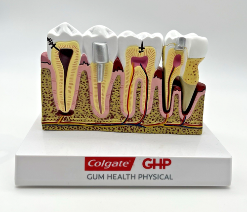 Colgate Dental Anatomical Oral Teeth Structure Model Standard for ...