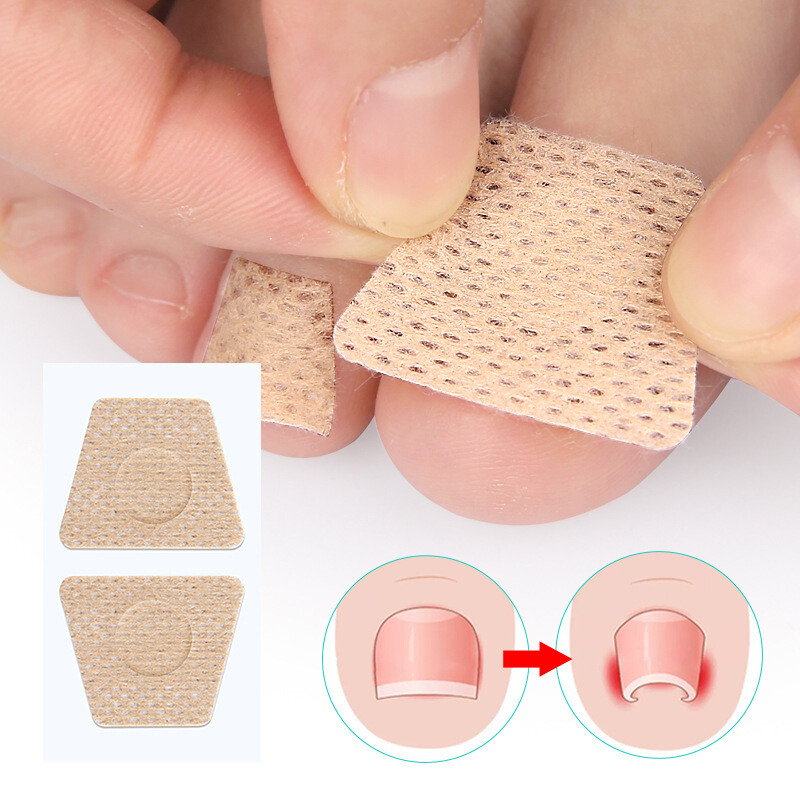 5Pairs Nail Care Patch Ingrown Toenail Correction Patch Foot Care ToYE ...
