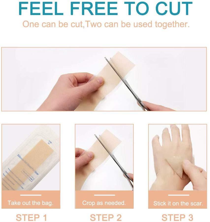 Aliver Silicone Soft Adhesive Fabric Strips C-Sections Scar Removal ...