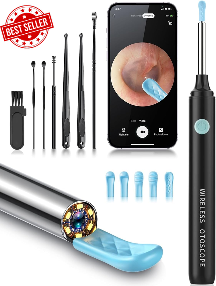 Ear Cleaner Camera Kit - Ear Wax Removal Camera with 1080P, Ear Camera ...