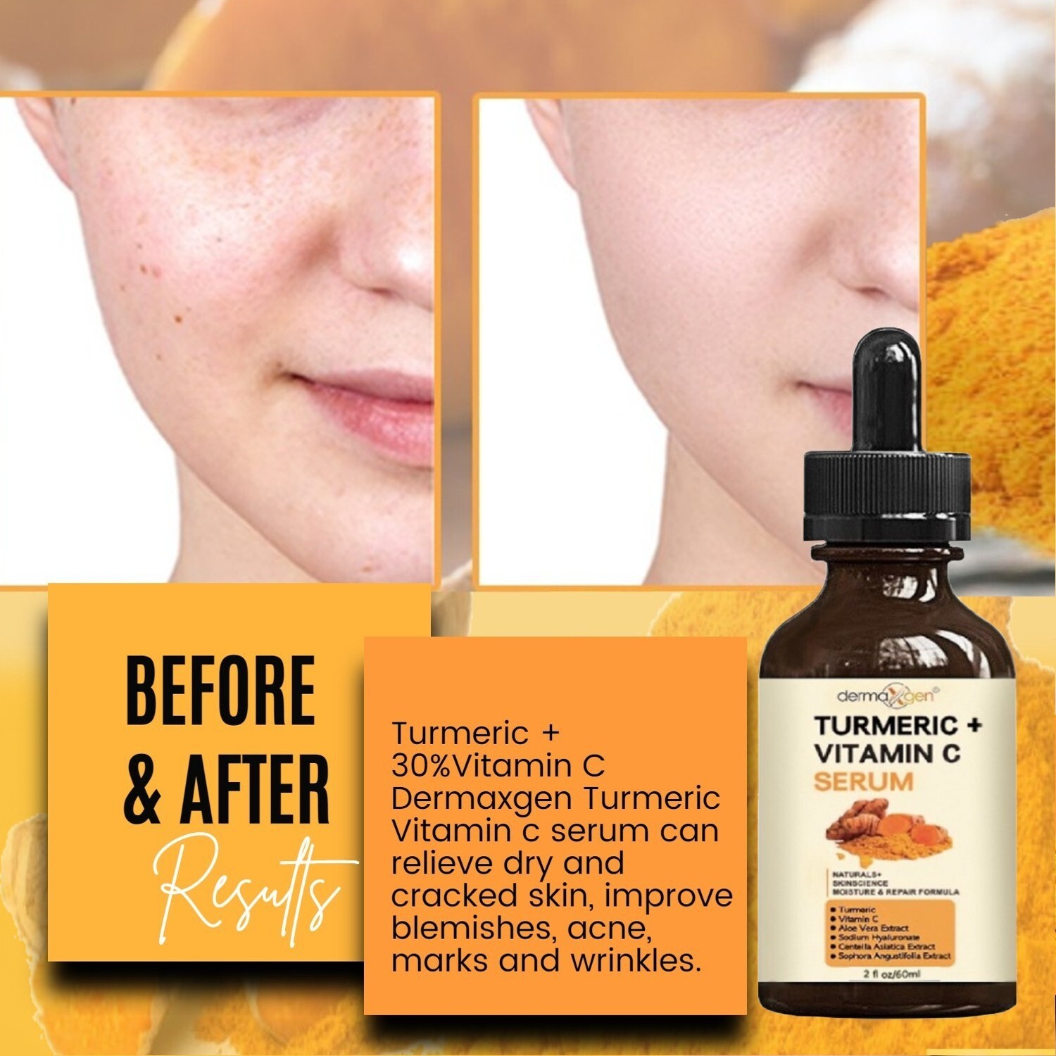 2 FL OZ -TURMERIC FACE SERUM + PIGMENTATION+BLEMISH CORRECTOR+DARK ...