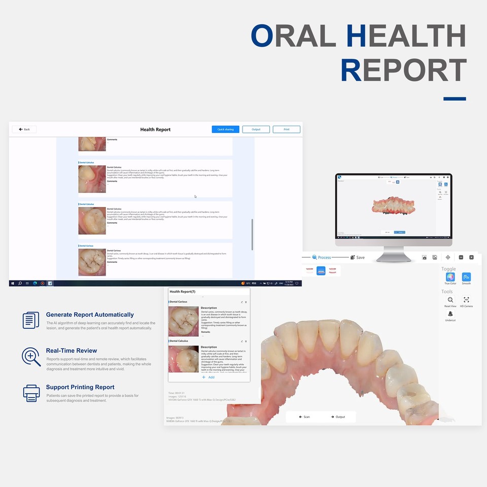 Dental Intraoral Scanner Digital Impression Intra Oral 3D True Color ...