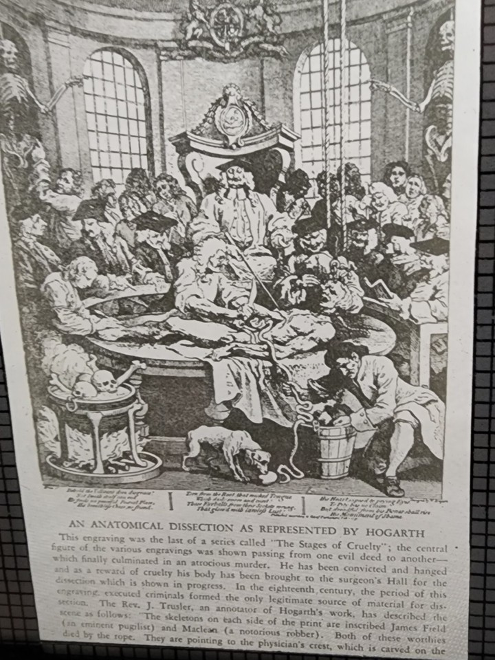 ANTIQUE GLASS SLIDE ANATOMICAL DISSECTION MEDIEVAL ENGRAVING BY HOGARTH ...