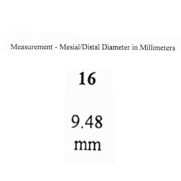 Dental SHORT Aluminum Shell Temporary Crowns All sizes #1-24 (10 pcs ...