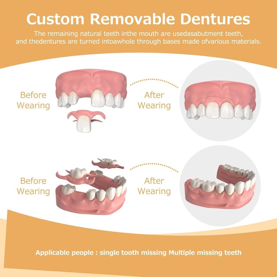 Partial Dentures Lightweight Unbreakable Replacement Teeth for Missing ...