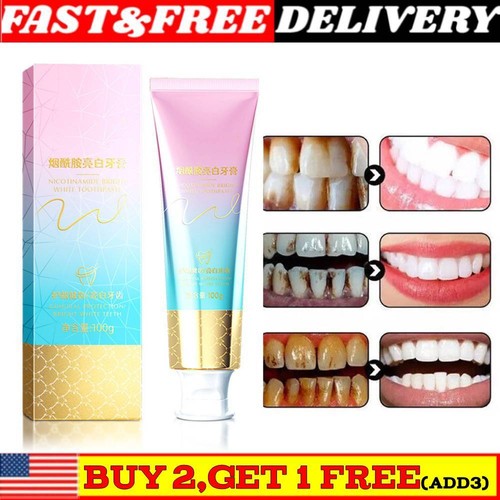 Body Accel -Niacinamide Whitening Toothpaste ~ 100 Grams 3.5 Oz -2025 ...