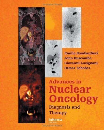 Advances in Nuclear Oncology : Diagnosis and Therapy by John Buscombe ...