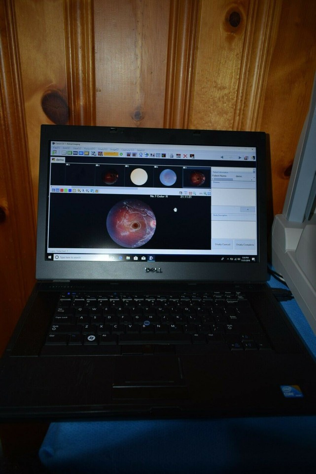 Canon CX-1 Fundus retinal camera non-myd/mydriatic FAF Fluorescein FFA ...