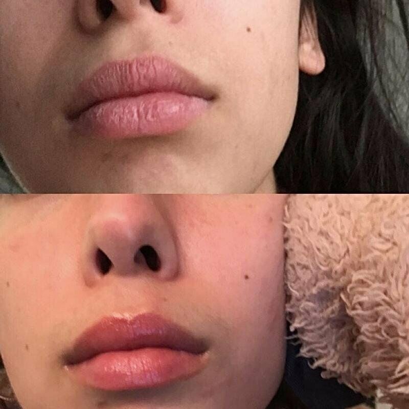 Vaseline Lip Therapy Rosy Lips Relieves Dry Dull and Cracked Lips 0.25 ...