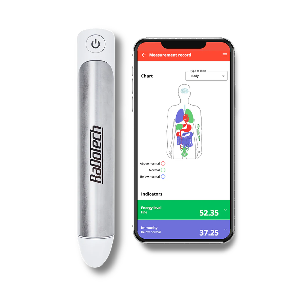 RaDoTech Wellness Fitness Tracker Smart Body Conductivity Analyzer Read ...