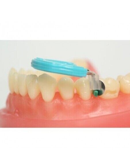 TDV Unimatrix R Sectional Matrix Band System Kit | eBay