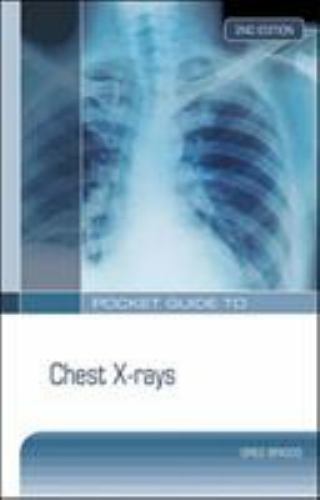 Pocket Guide to Chest X-Rays by Briggs, Greg 9780070138773| eBay