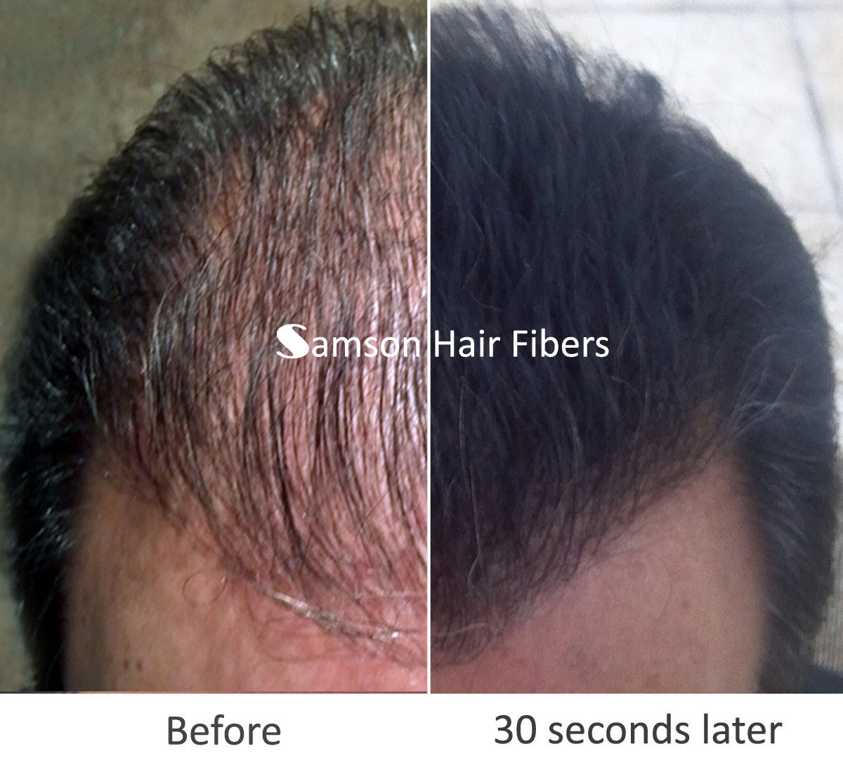 Samson Best Hair Loss Concealer Building Fibers BROWN 300g Refill USA ...