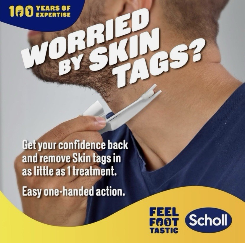 Scholl Freeze Away Skin Tag Removal Kit - Removes Skin Tags Fast ...