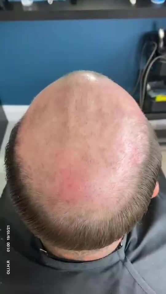 US Thin Skin Toupee Invisible Men Hair Replacement System for Bald ...