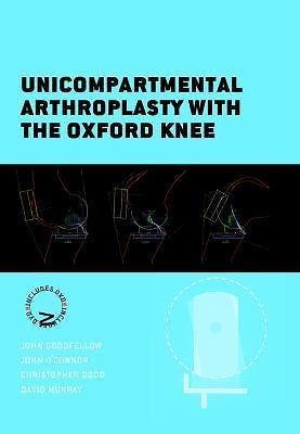 Unicompartmental Arthroplasty with the Oxford Knee by John Goodfellow ...