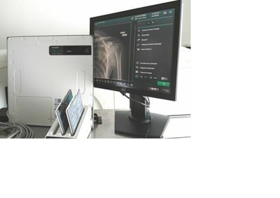 Imaging & Aesthetics Supplies - Xray Cassette