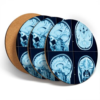 4 x Coasters - Brain CT Scans Hospital Doctor Surgeon #44434 | eBay ...