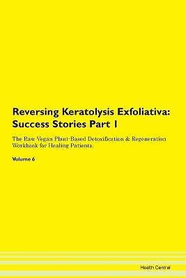Reversing Keratolysis Exfoliativa, , Paperback | eBay UK