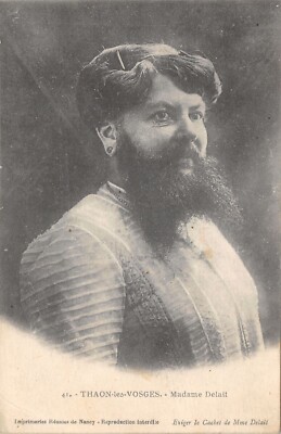 Circus Freak Lady with Beard Original old 1915s Vintage Photo Postcard ...