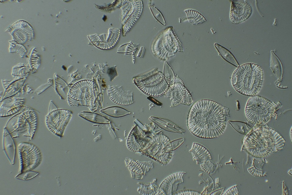 Antique Microscope Slide with Decorative Ringing. Diatom Strew | eBay