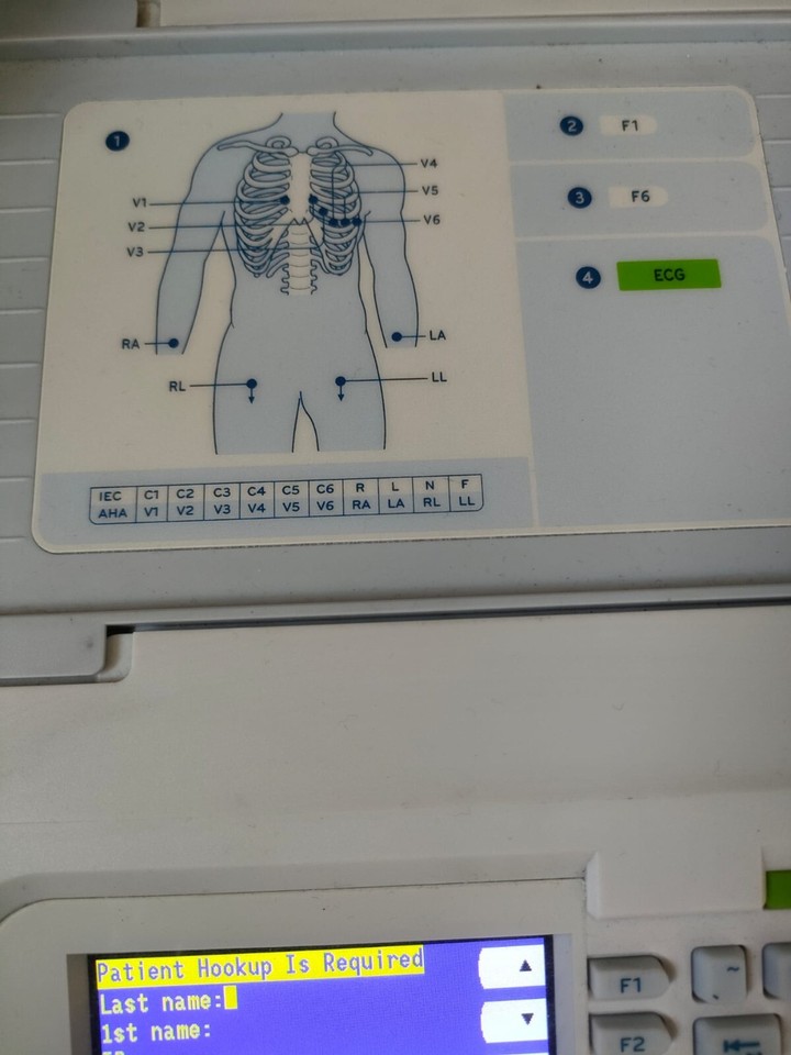 MORTARA 150C RESTING ECG EKG ELECTROCARDIOGRAM MACHINE USED EXCELLENT ...