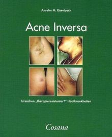 Acne Inversa von Eisenbach, Anselm M. | Buch | Zustand sehr gut | eBay.de