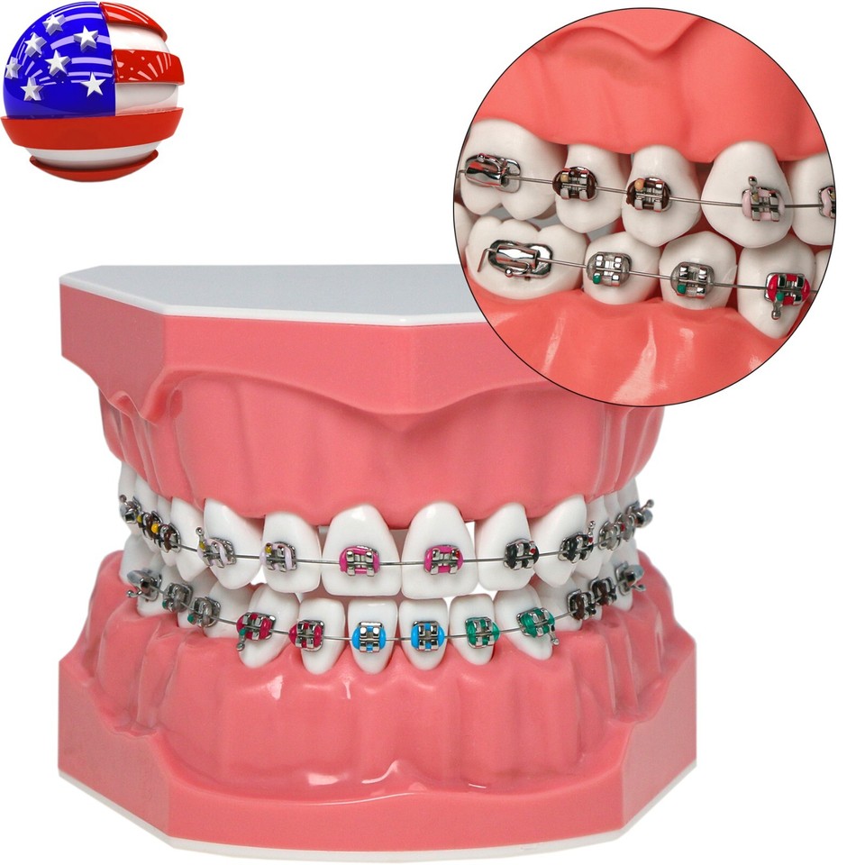 US Dental Overdenture Implant Model Preparation Training Teaching Ortho ...