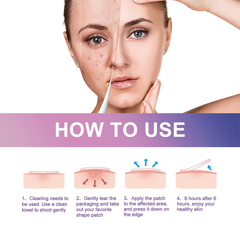 216Pcs Pimple Patches Acne Spot Dots Zits Hydrocolloid Scar Face Skin ...