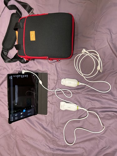 Philips Lumify Portable Ultrasound Anesthesia ICU ER POCUS Linear ...