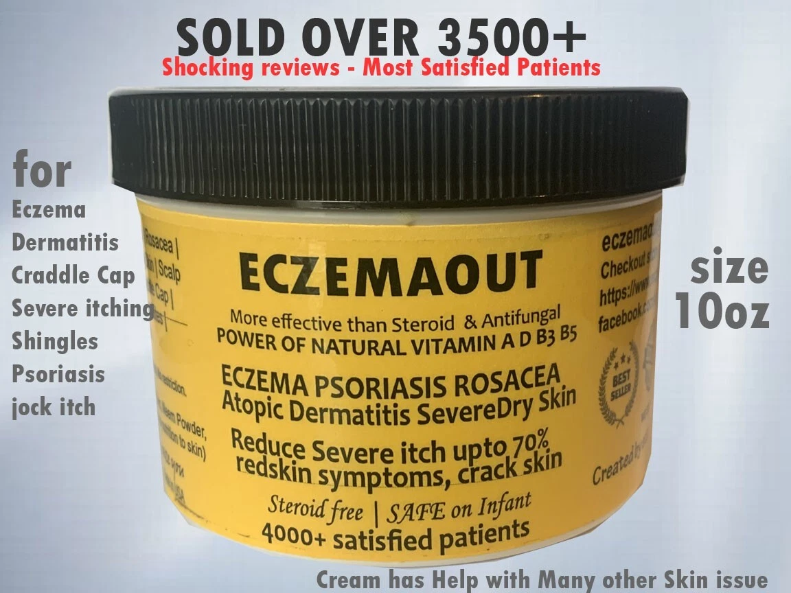 Eczema Arms Treatment