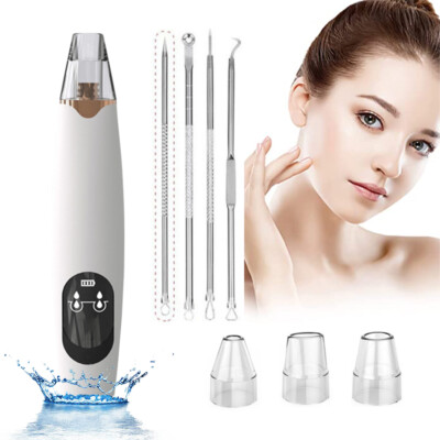 Electric Blackhead Remover Pore Vacuum Acne blackhead and whitehead ...