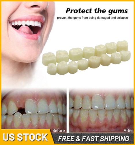 50/70Pcs Temporary Teeth Crown Resin Posteriors Anterior Molar Tooth ...