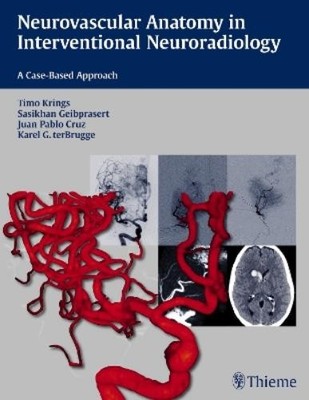 Karel ter Brugge Timo Krings Neurovascular Anatomy in In (Paperback ...