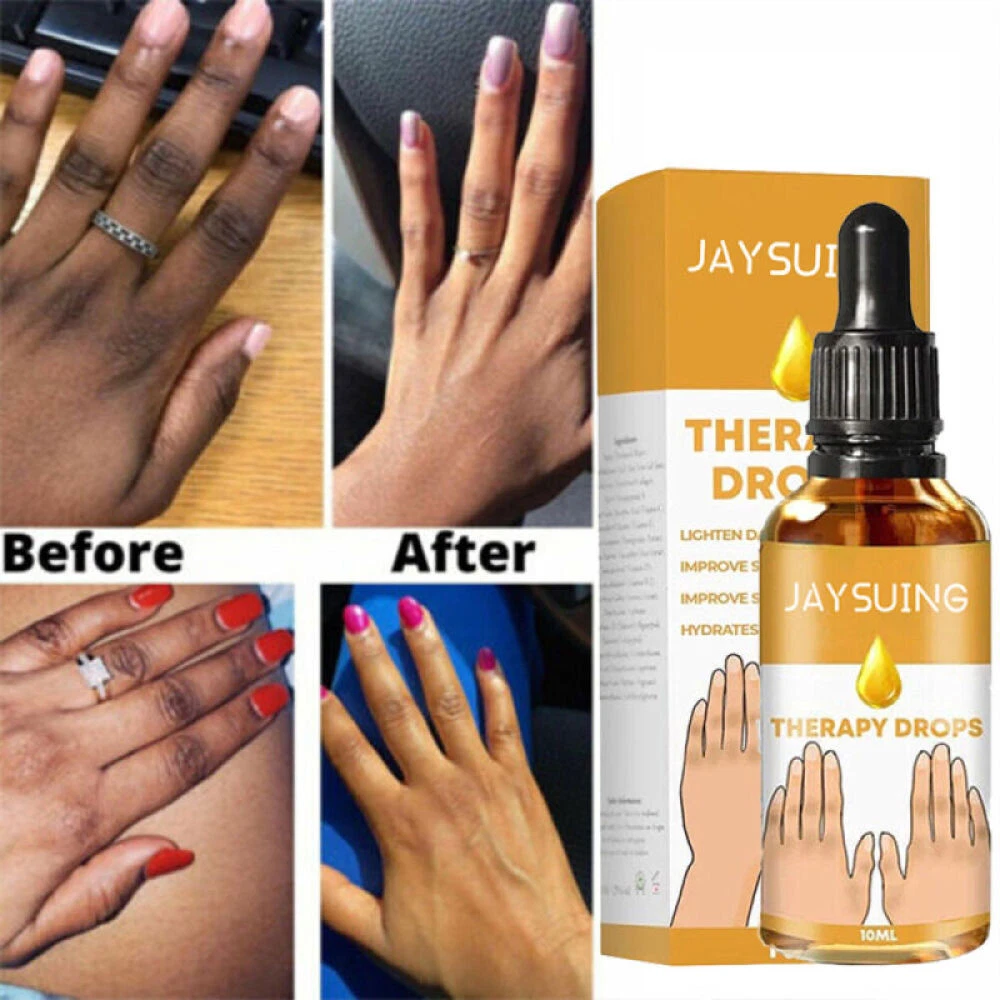 Elbow Whitening