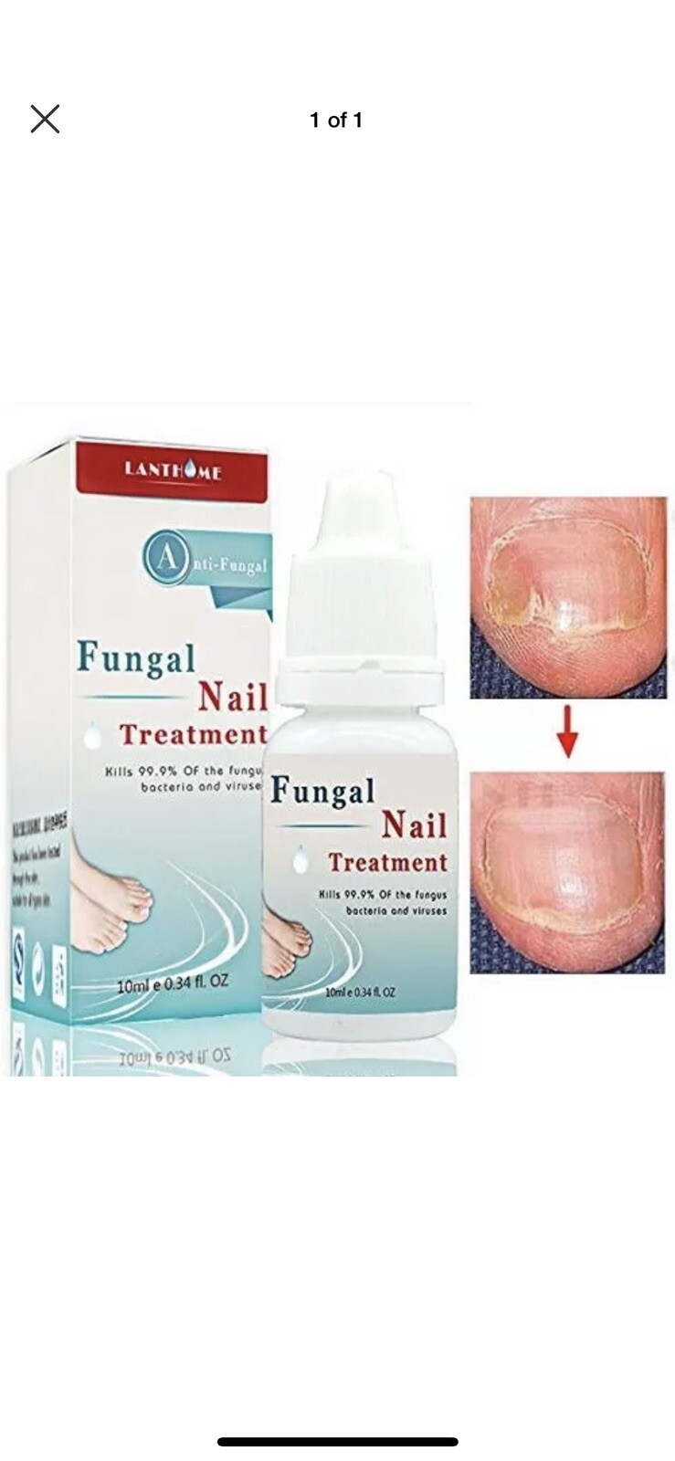 LANTHOME Fungal Liquid Nail Treatment Nail And Foot Whitening Toenail ...
