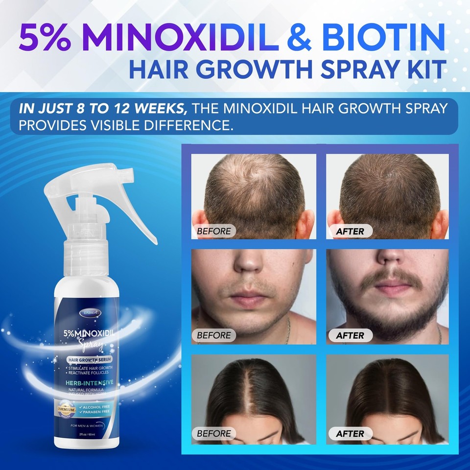5% Minoxidil for Men, Minoxidil Spray, Minoxidil for Women Hair Growth ...