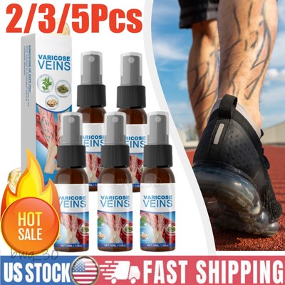 👍Varicose Vein Spray Herbal Varicose Veins Treatment Spray for Legs ...