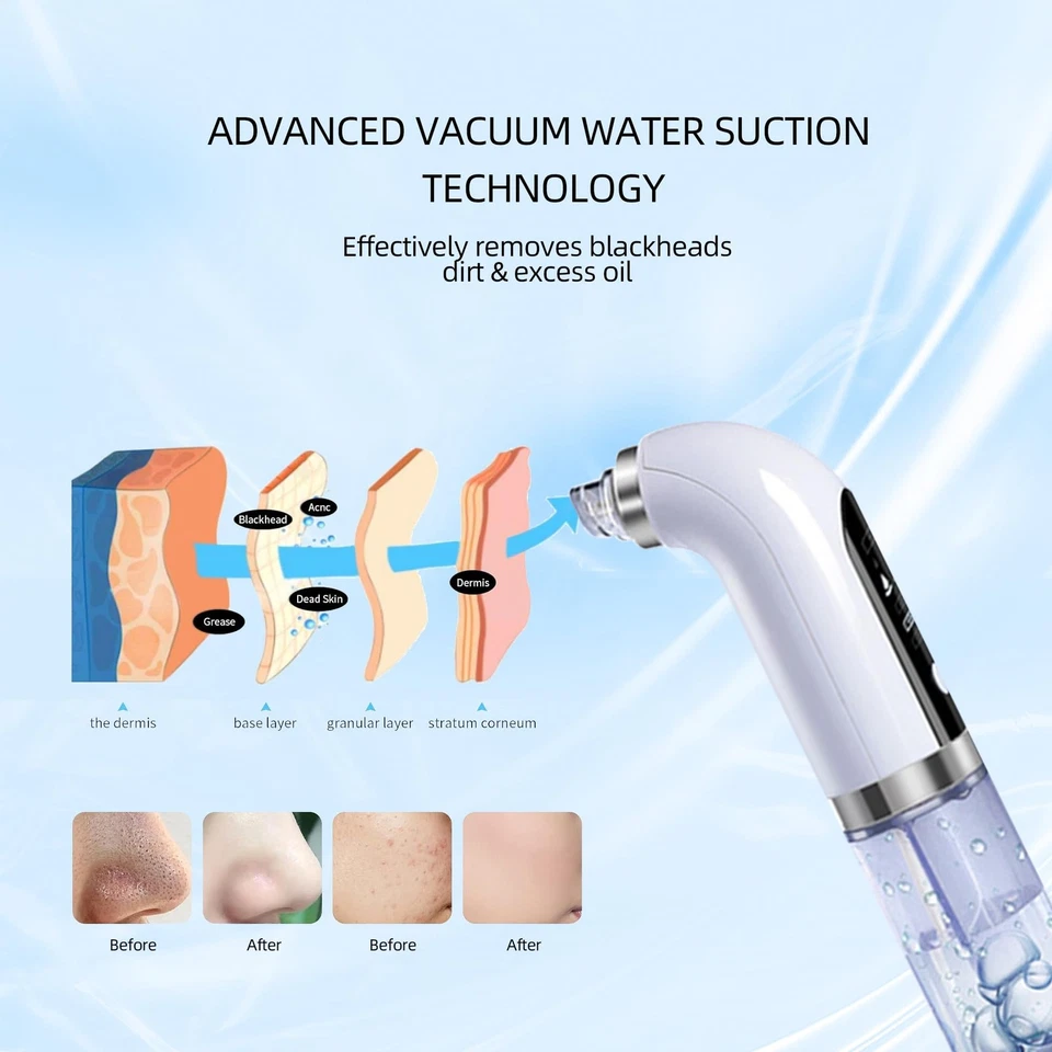 Electric Blackhead Remover Vacuum Pore Cleaner Nose Suction Acne ...