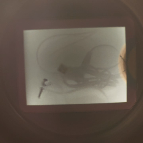 BAE SKEETIR L Clip On Thermal Monocular W/Data Cables & Wilcox Flip ...