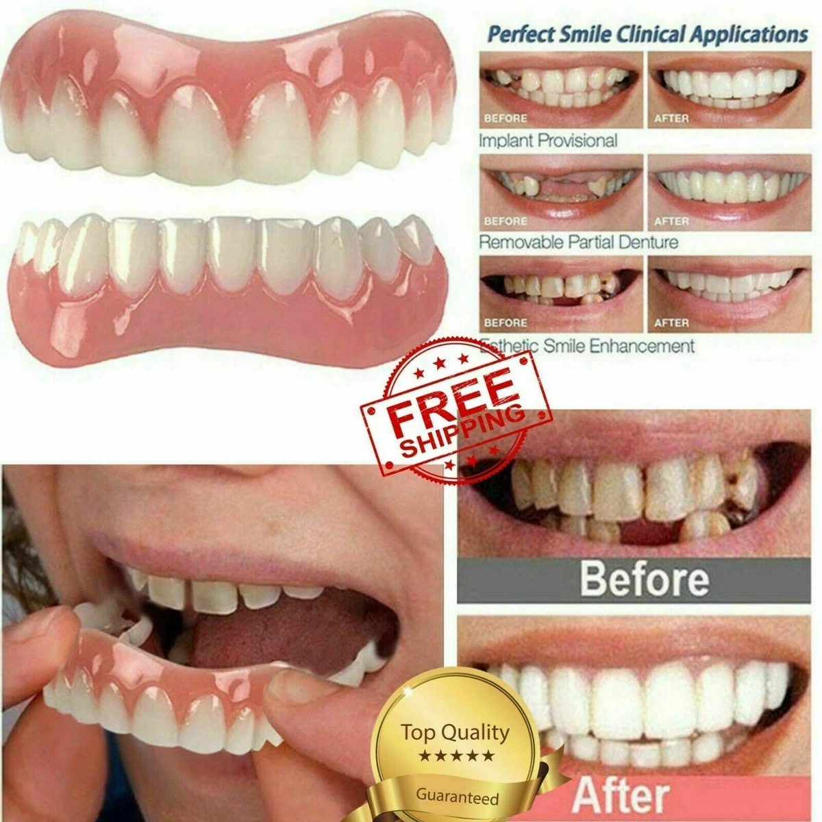 False Teeth Before And After