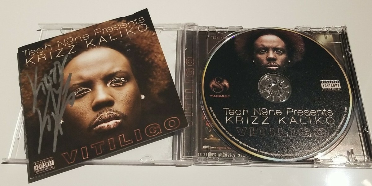 Krizz Kaliko Eye Condition